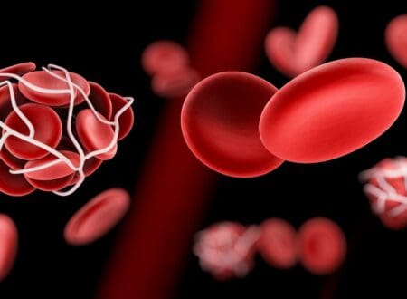 Sofradex Ear drops - MyDr.com.au