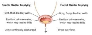 Continence in spina bifida: bladder and bowel - MyDr.com.au
